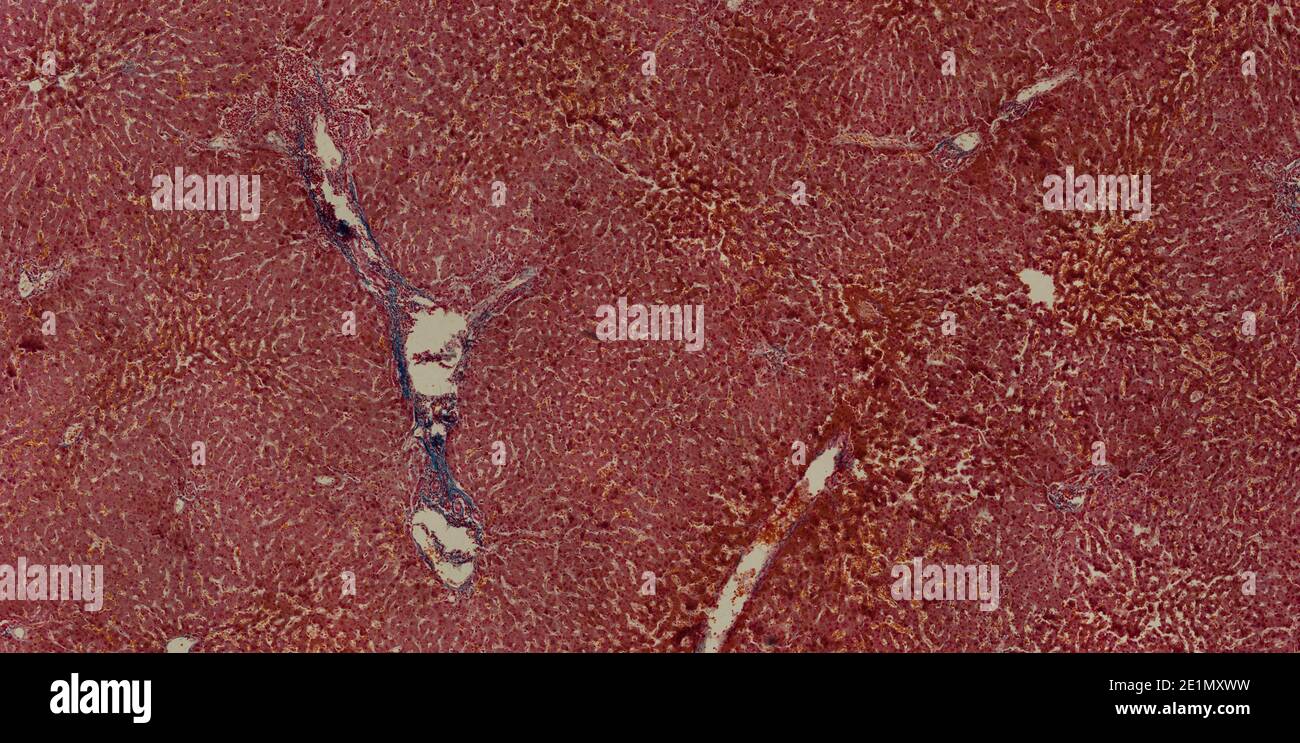 cross section cut of human body cells under a scientific microscope ...