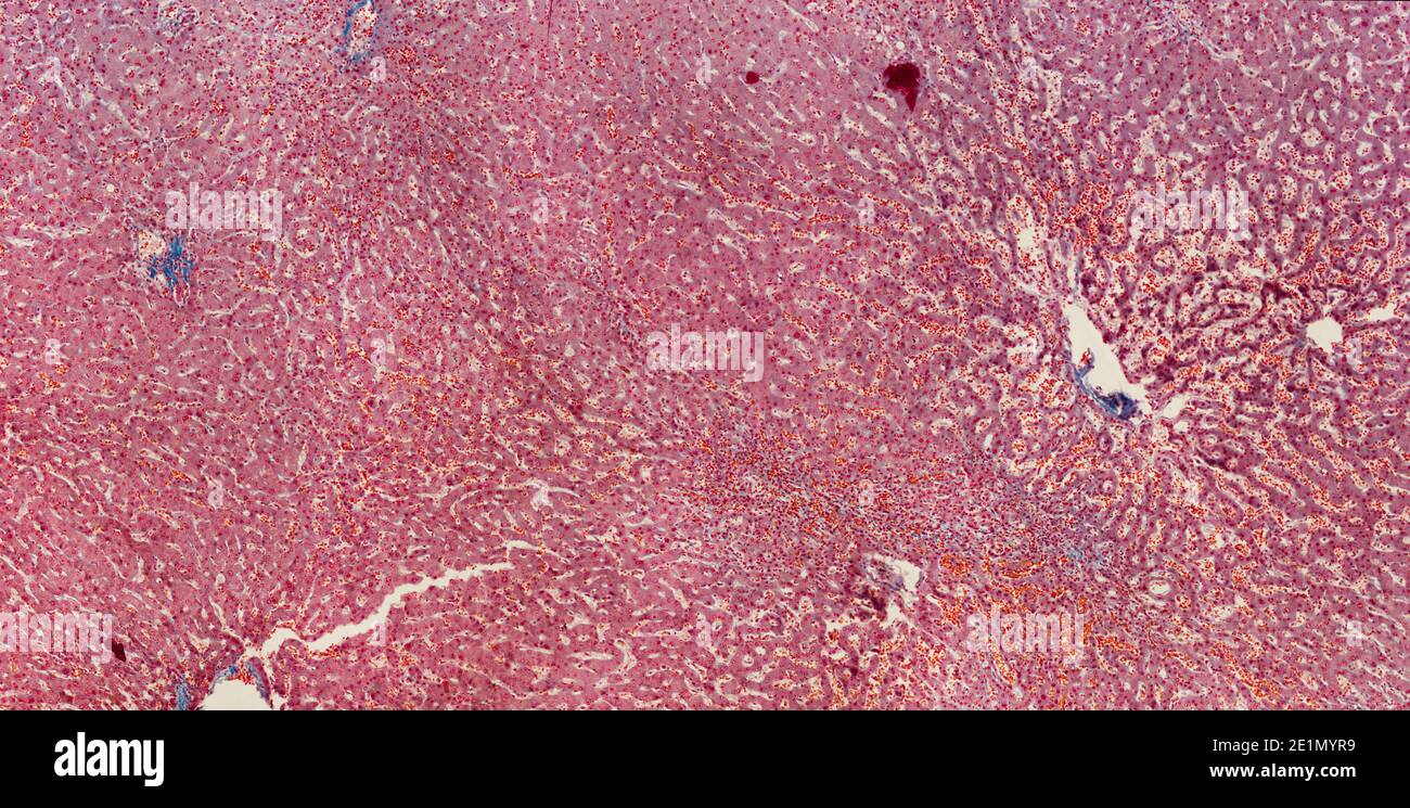 cross section cut of human body cells under a scientific microscope ...