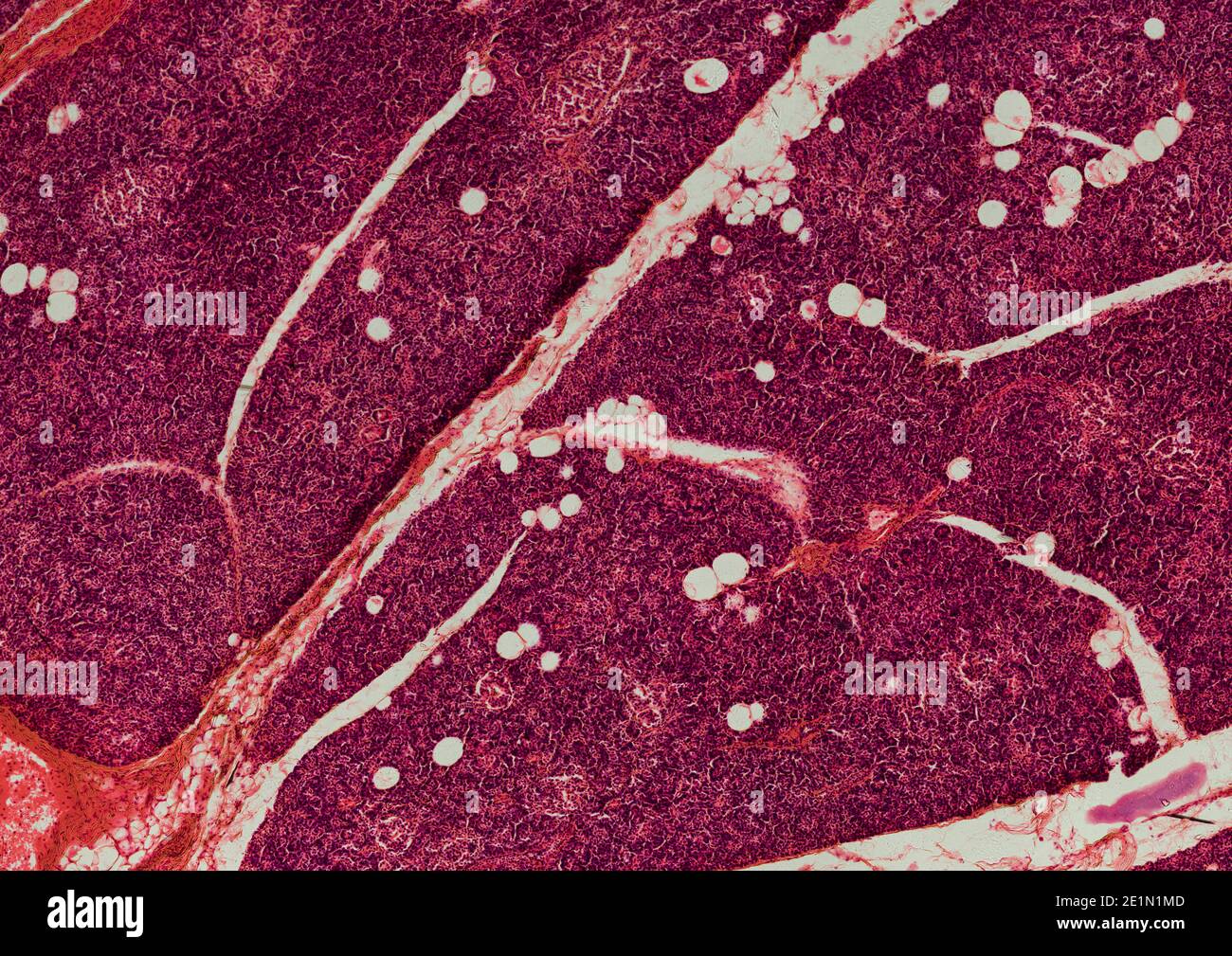 Human Body Cells Microscope Haemoglobin Stock Images, Royalty Free