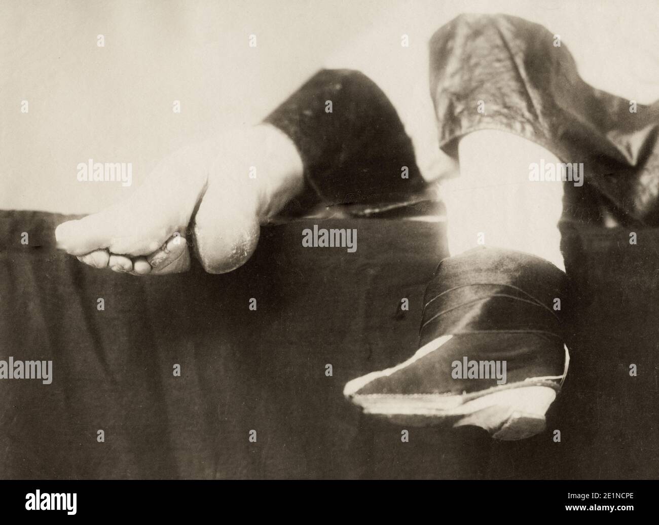 Bound foot china hi-res stock photography and images - Alamy