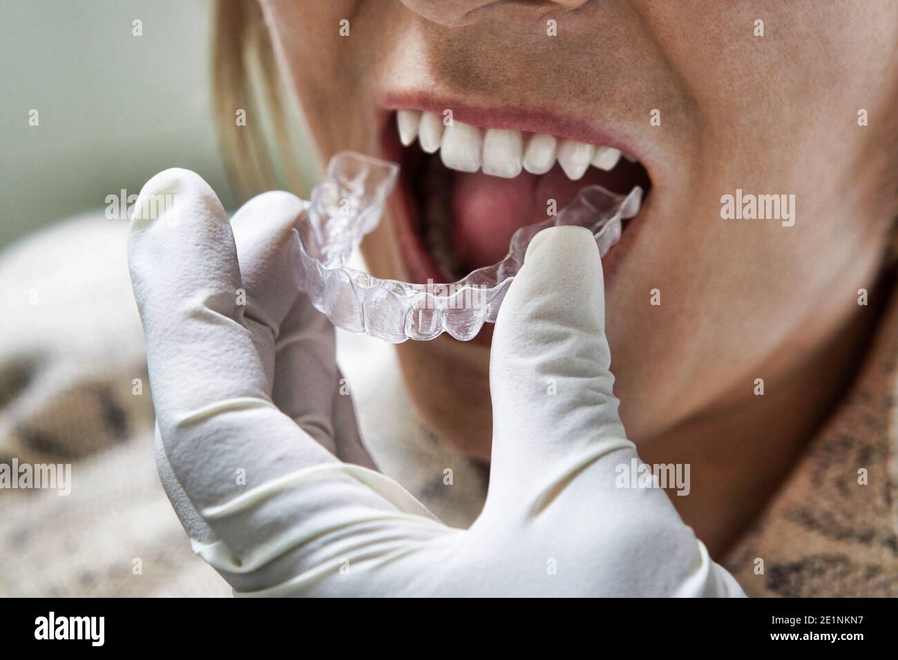 Mixture of teeth hi-res stock photography and images - Alamy