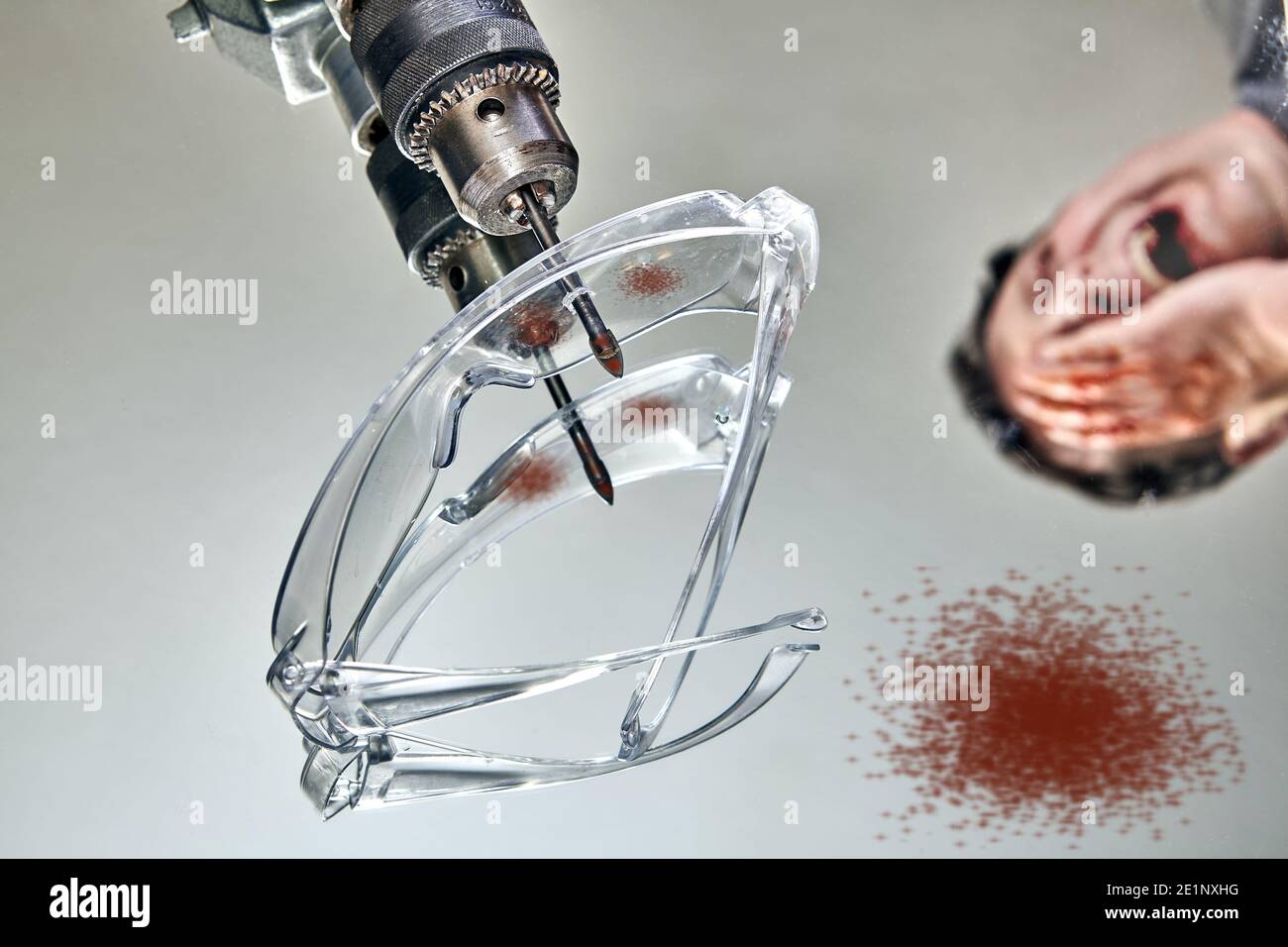 Work injury as a result of an accident at an industrial plant Stock ...
