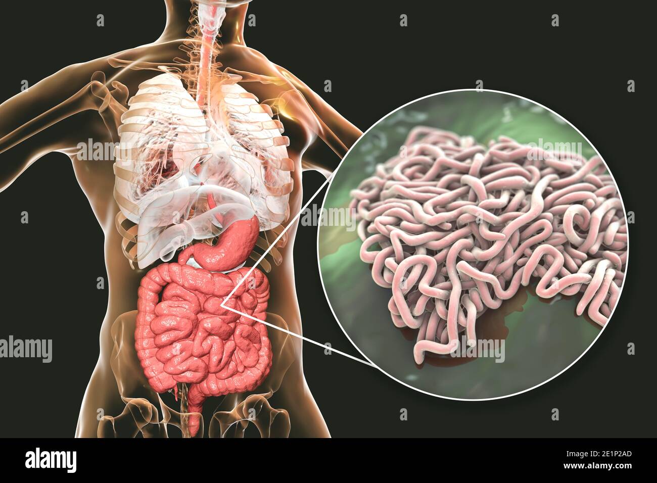 Round worms in human intestine, illustration Stock Photo - Alamy