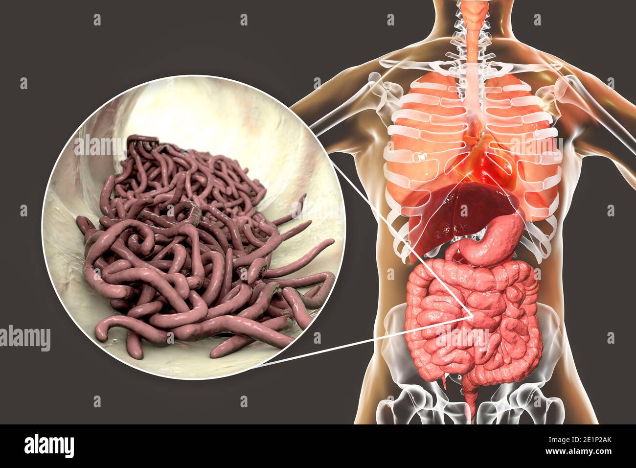 Round worms in human intestine, illustration Stock Photo - Alamy