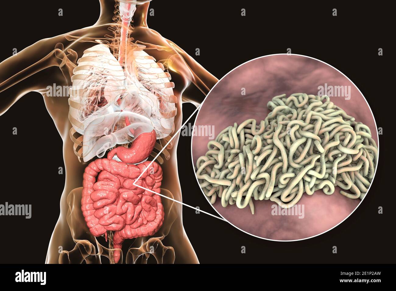 Round worms in human intestine, illustration Stock Photo - Alamy