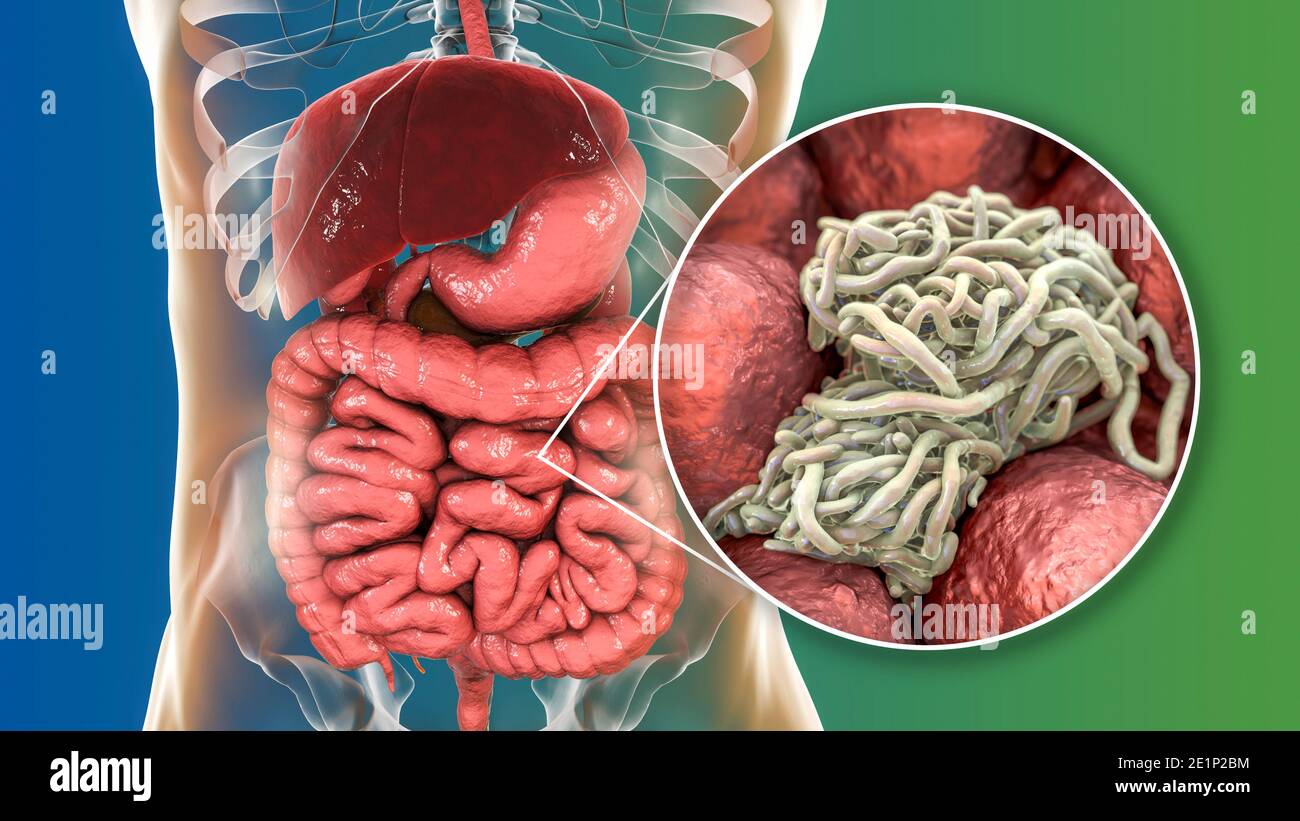 Round worms in human intestine, illustration Stock Photo - Alamy
