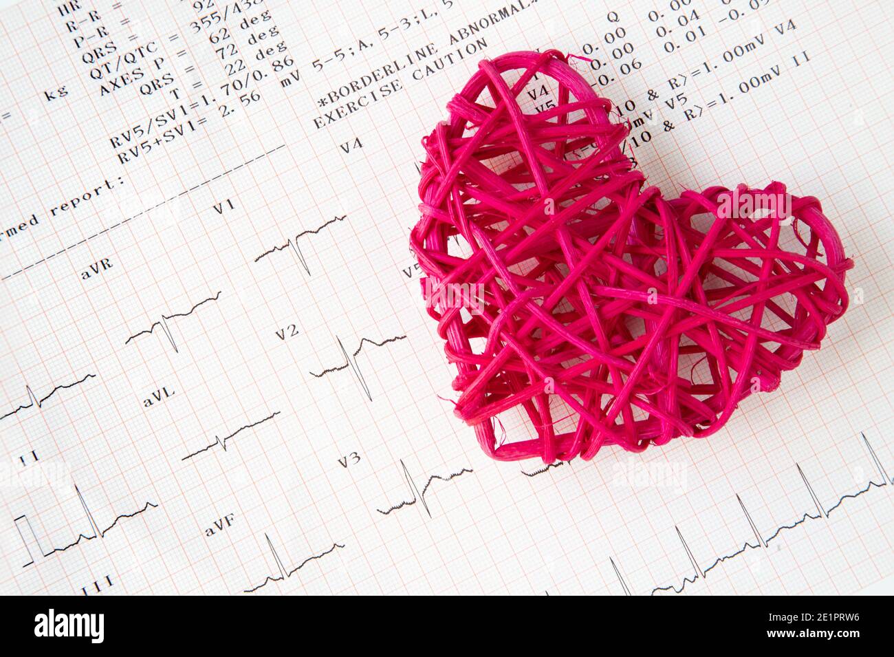 Normal electrocardiogram hi-res stock photography and images - Alamy