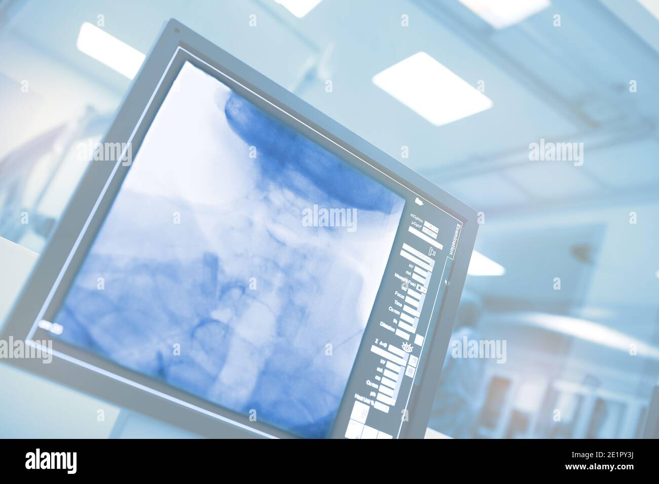 Hospital x ray room monitor screen hi-res stock photography and images ...
