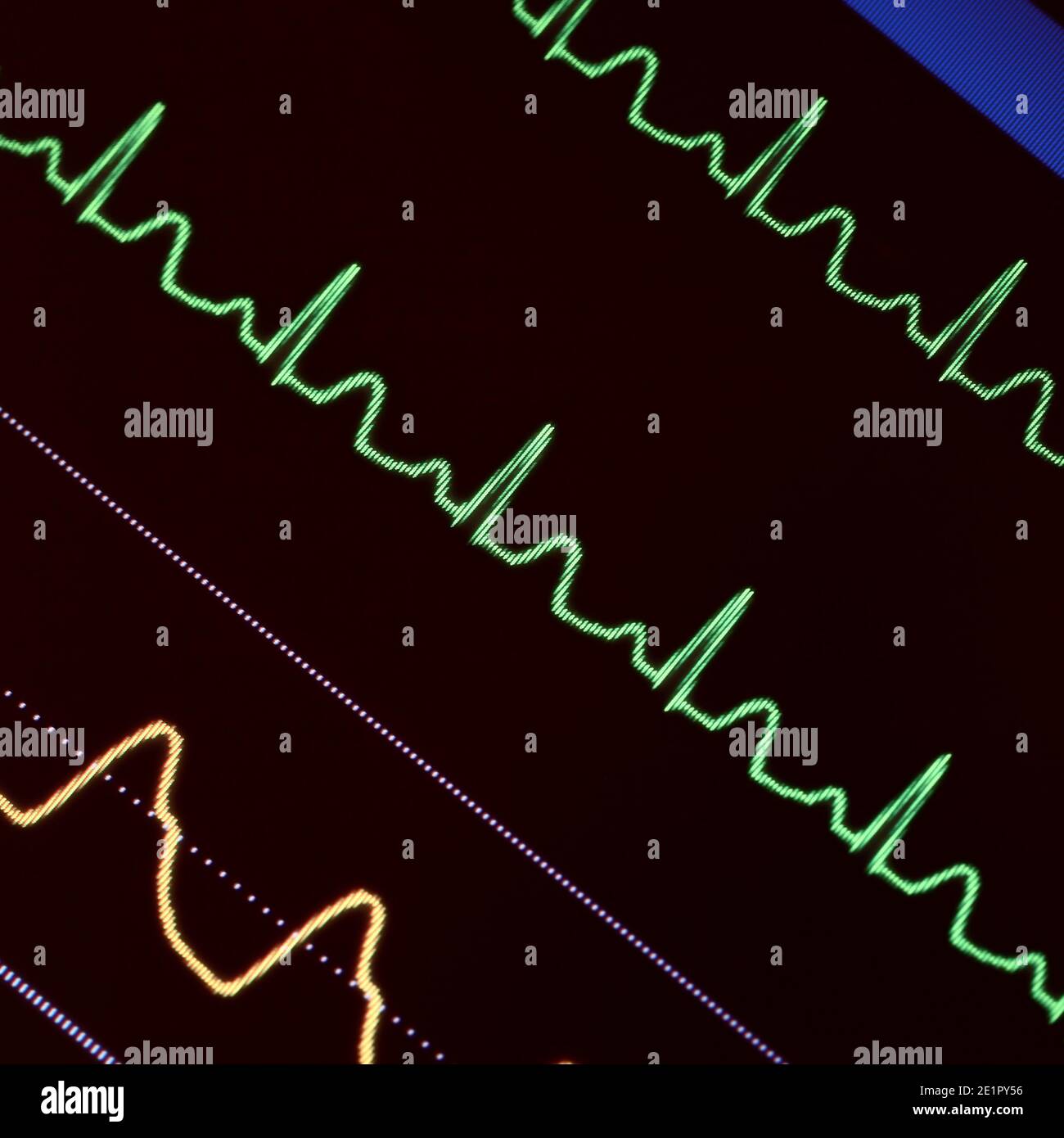 Monitoring hi-res stock photography and images - Alamy
