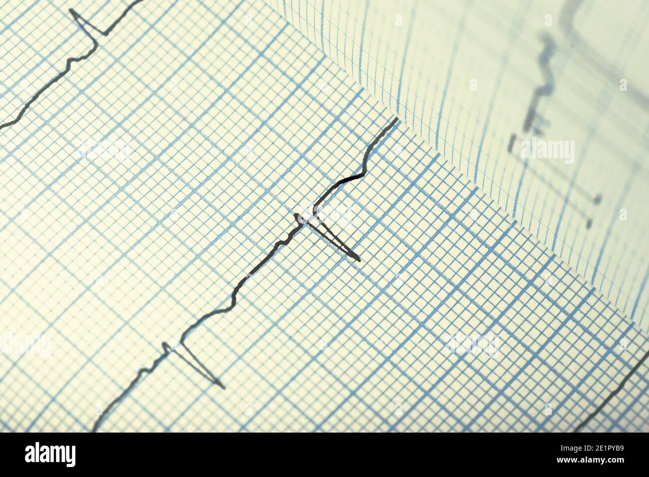 ECG paper as medical background Stock Photo - Alamy