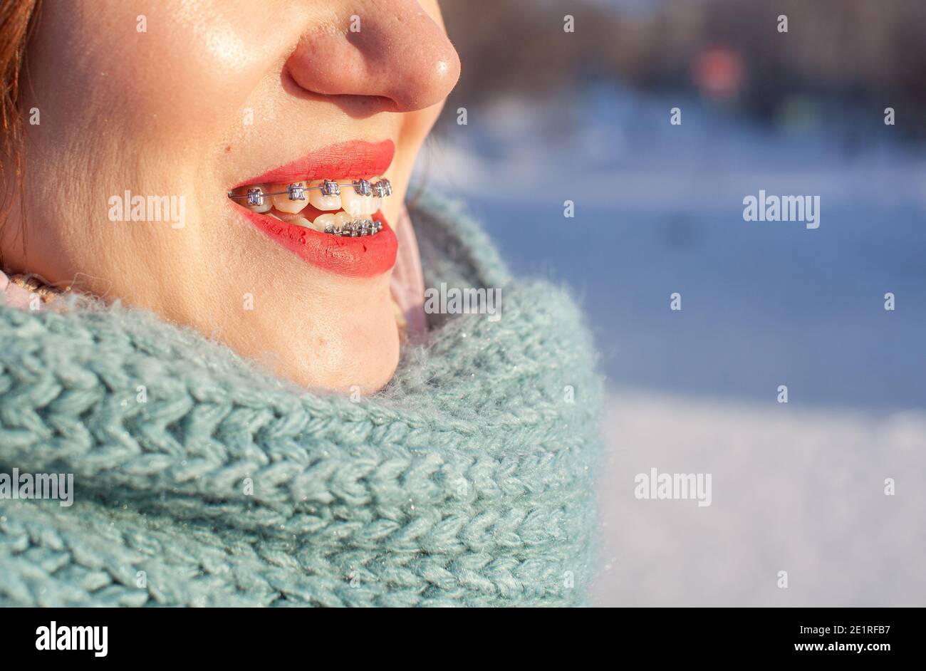 The girl has braces on her teeth. A girl in the winter on the street ...