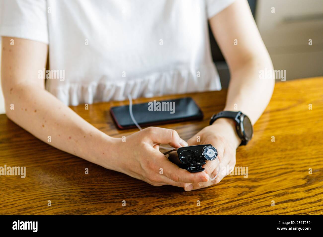 Insulin pump hi-res stock photography and images - Alamy