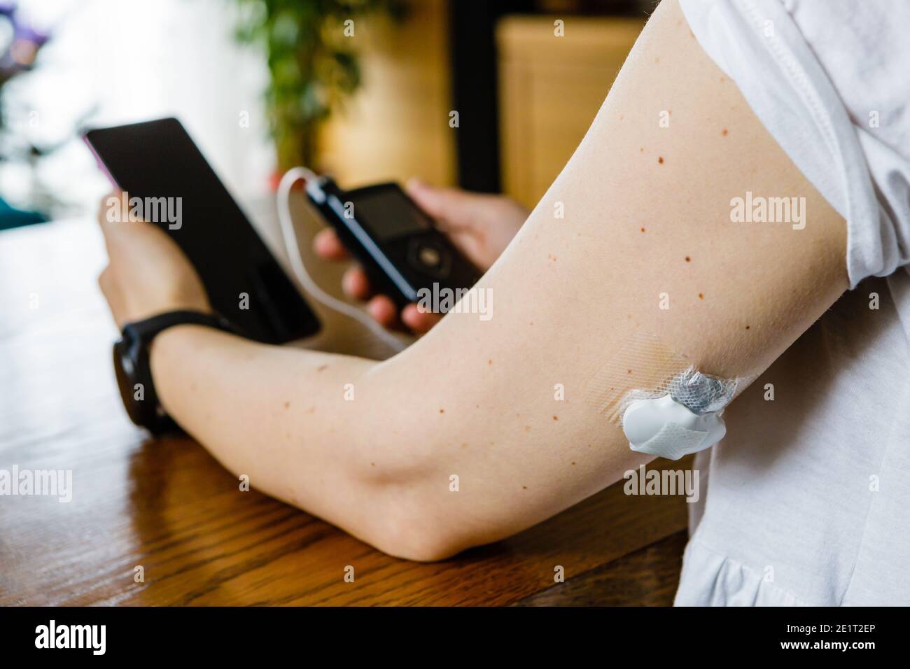 Modern diabetes treatment, woman checking glucose level and dosing ...