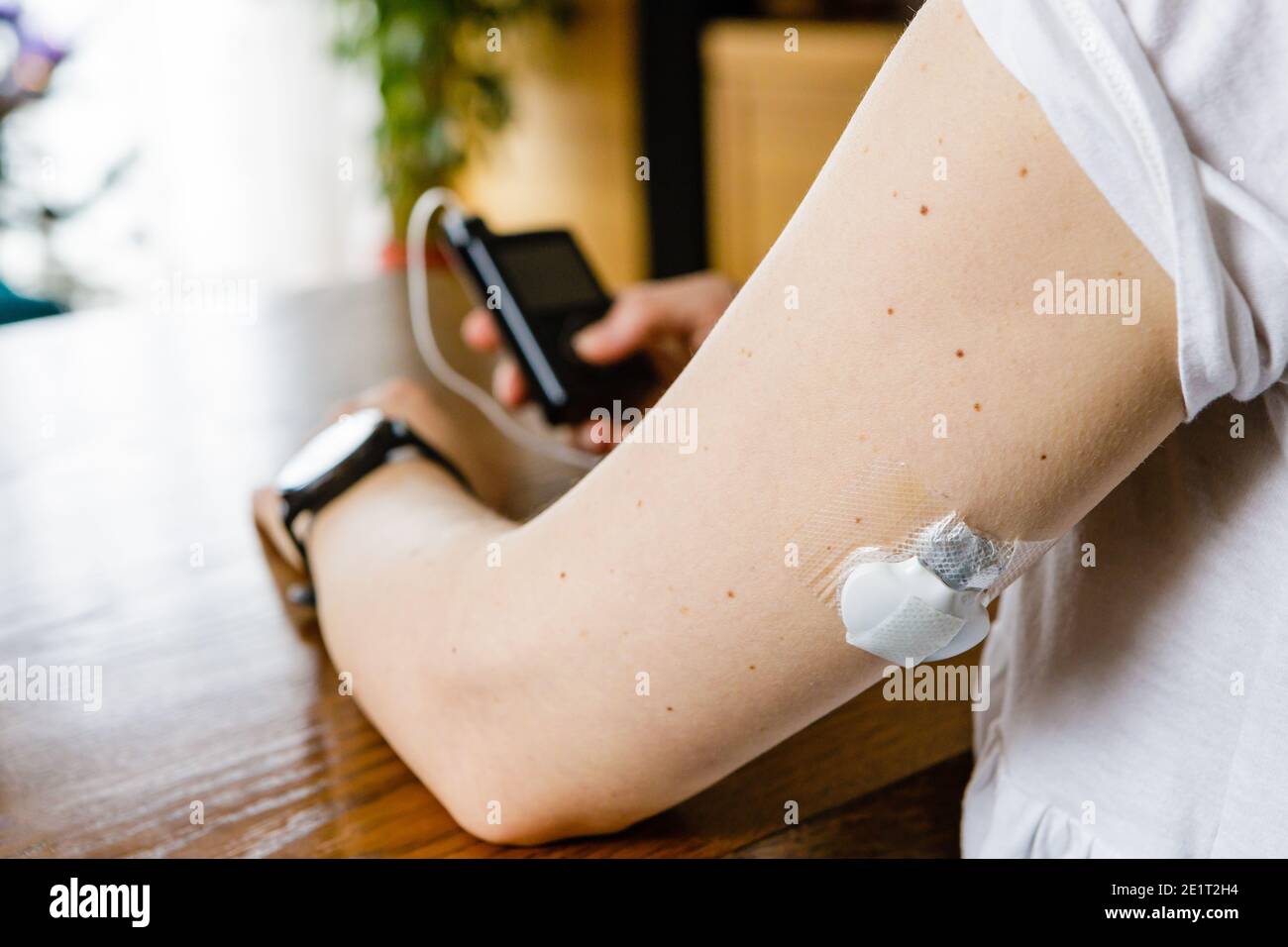 Modern diabetes treatment, woman checking glucose level and dosing ...