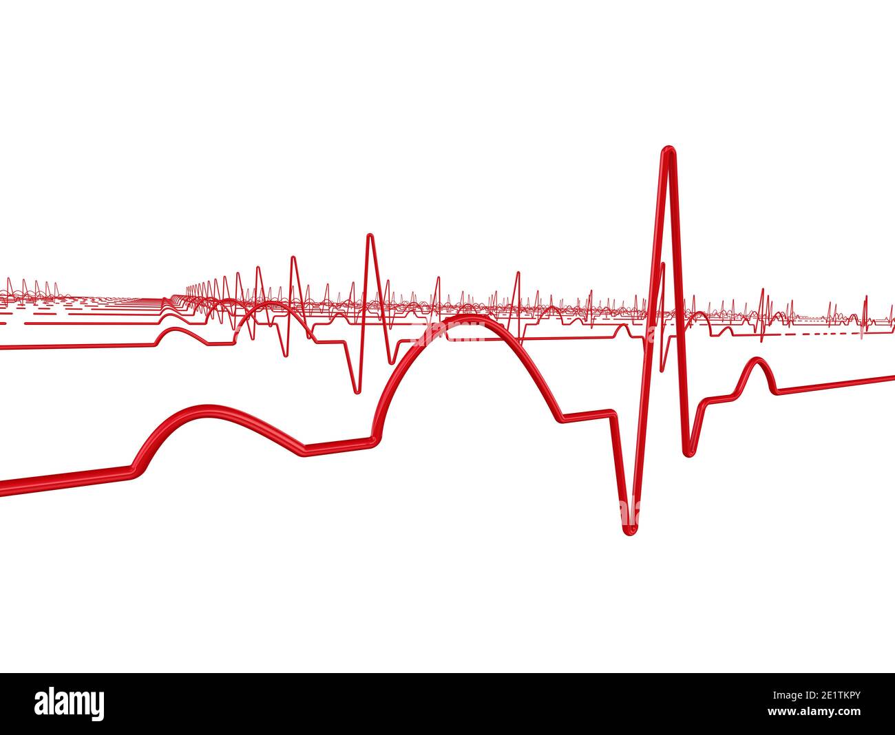 Electrical Recording Of The Heart (Activity) at Vincent Flora blog