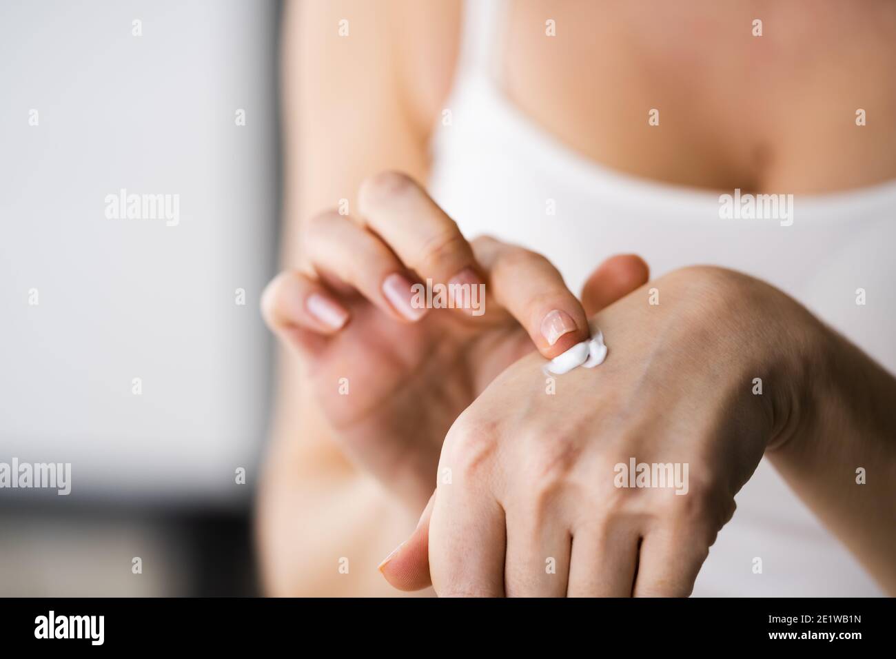 Applying Cream On Healthy Dry Skin Hand Stock Photo - Alamy