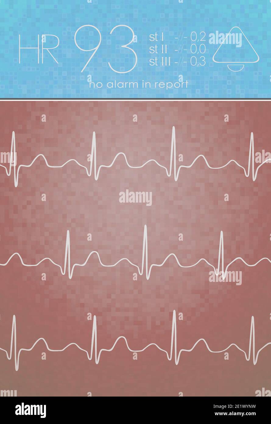 Normal ecg hi-res stock photography and images - Alamy