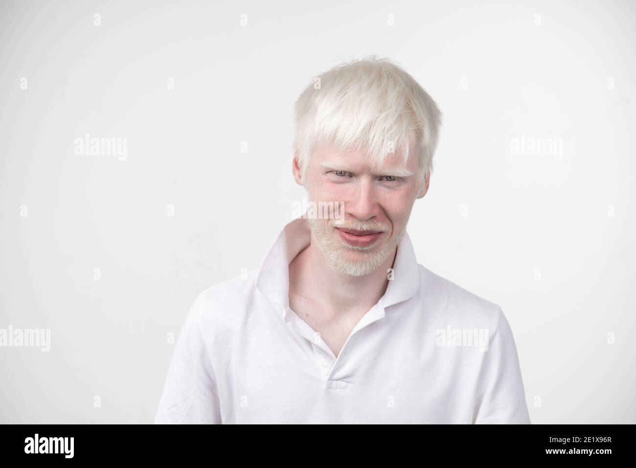 albinism albino man in studio dressed t-shirt isolated on a white ...