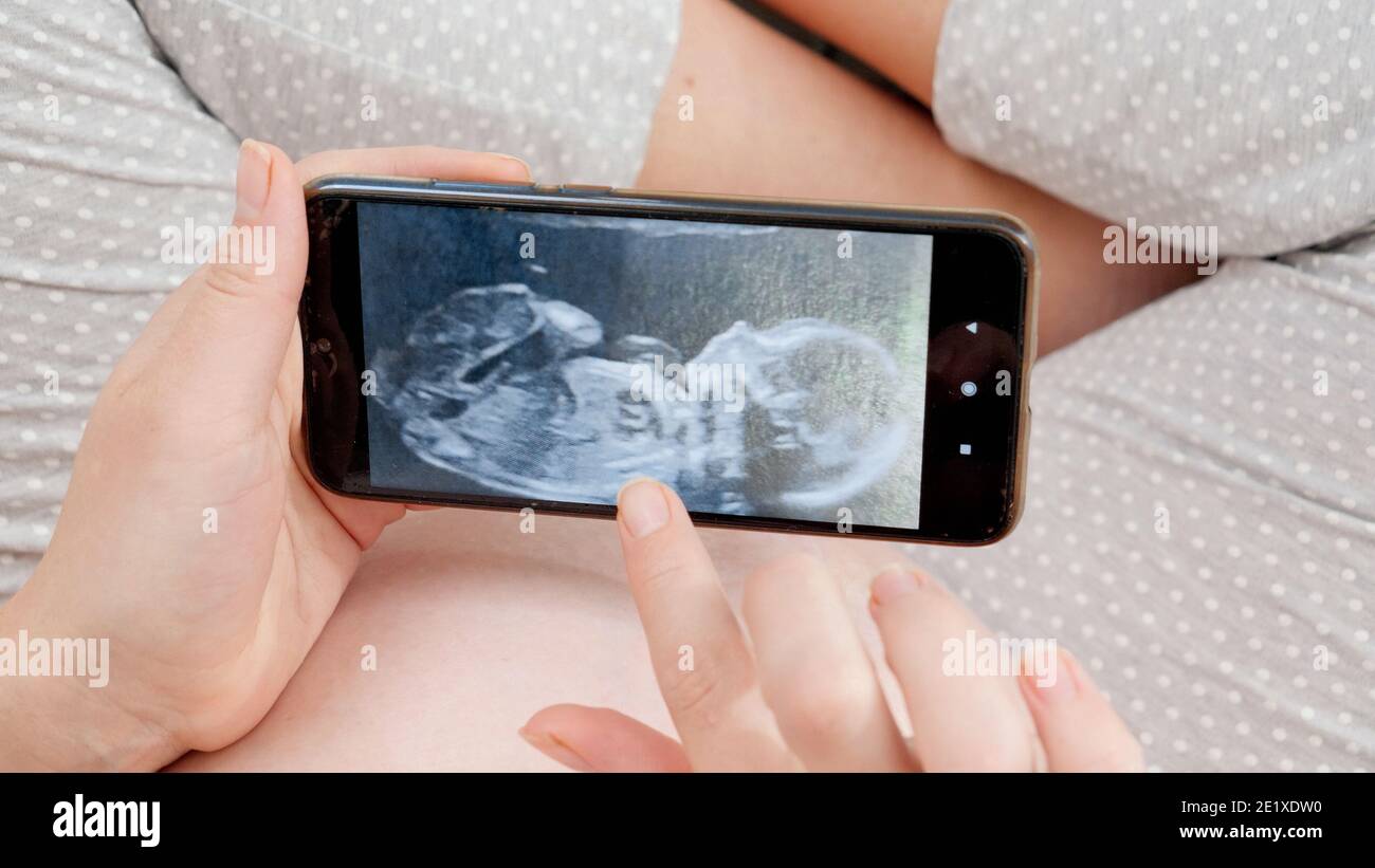 CLoseup of ultrasound image of unborn baby on smartphone screen ...
