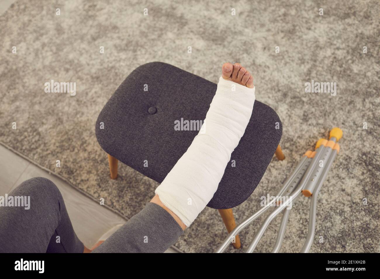 Woman Leg Cast Crutches In High Resolution Stock Photography and Images ...