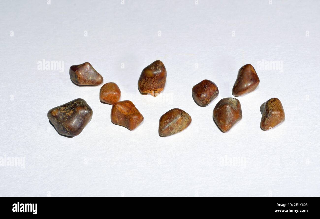 Gallstones hi-res stock photography and images - Alamy
