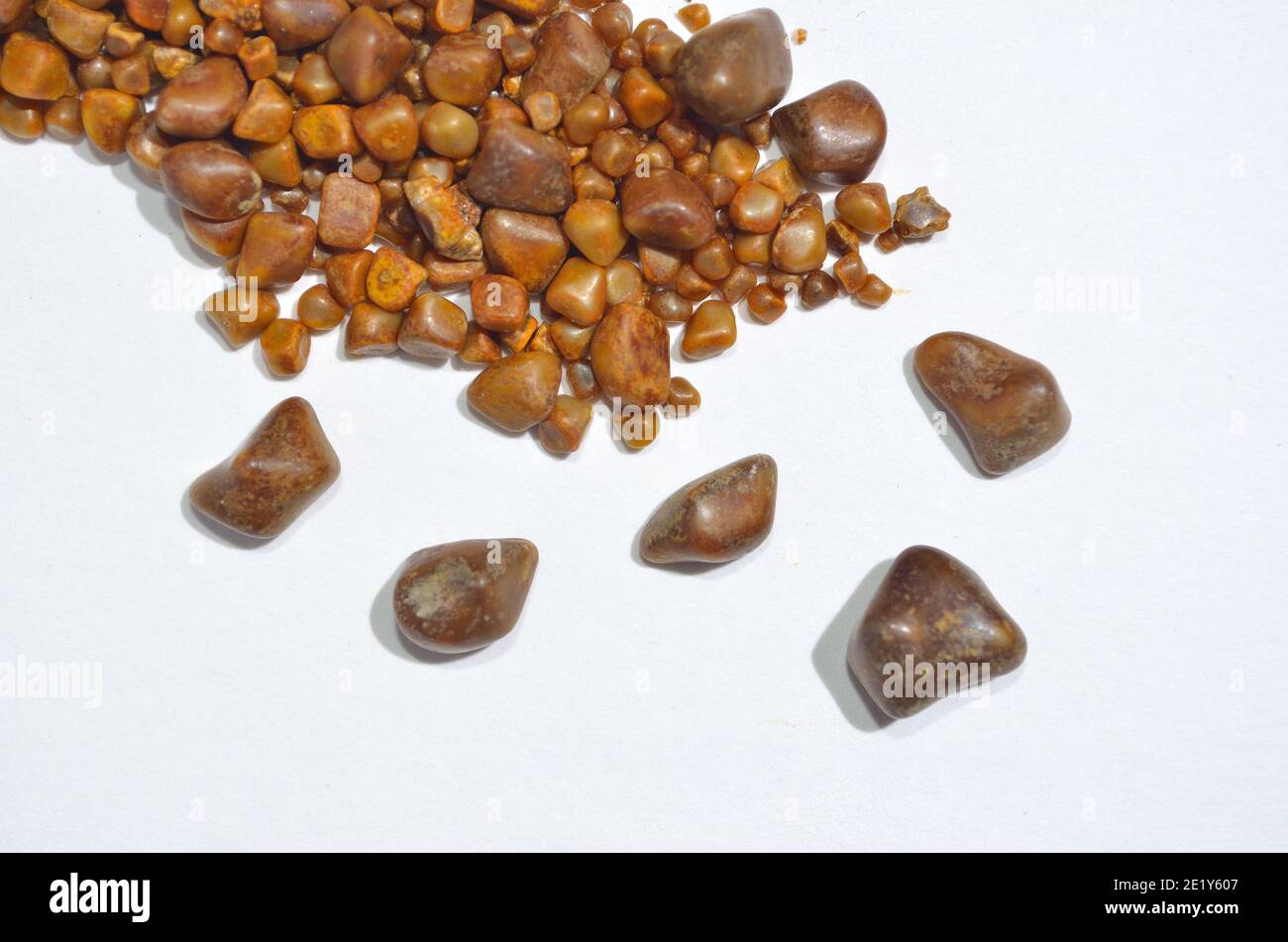 Gallstones hi-res stock photography and images - Alamy