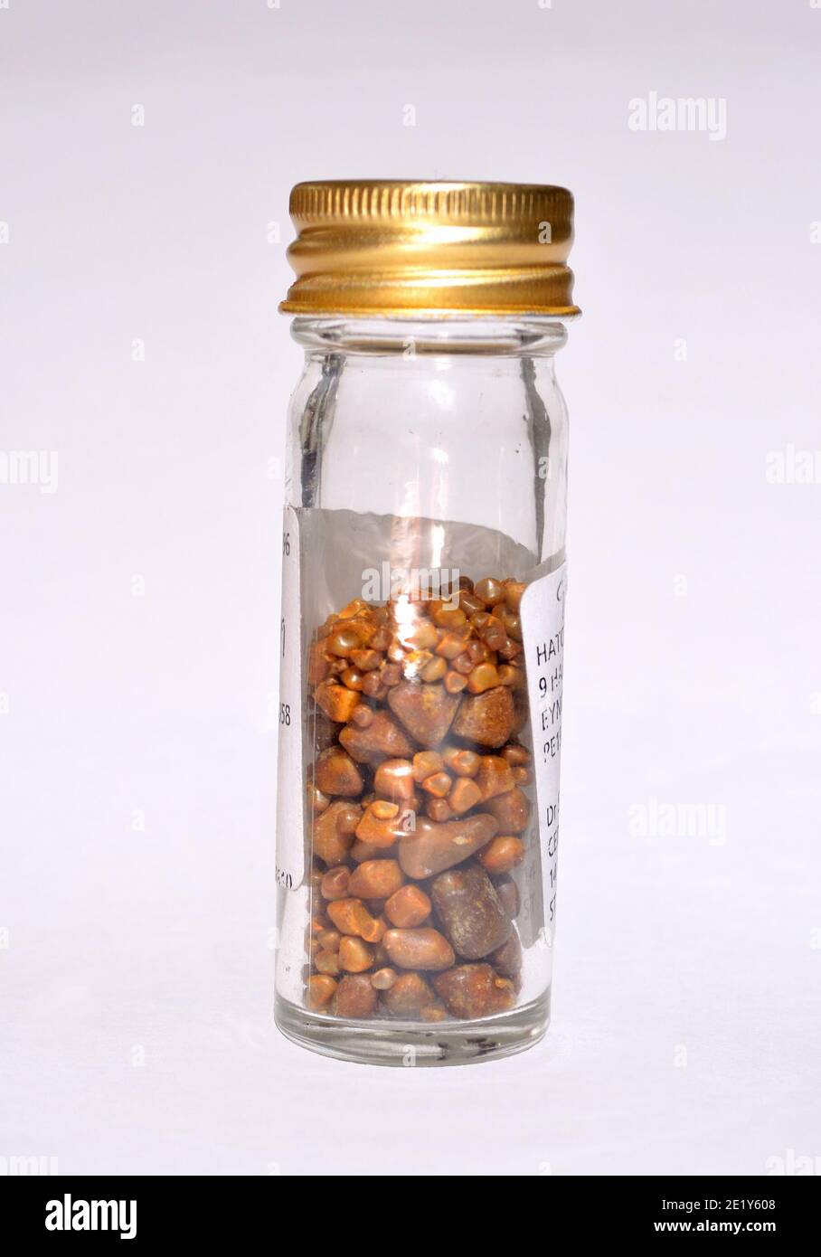 Gallstones hi-res stock photography and images - Alamy
