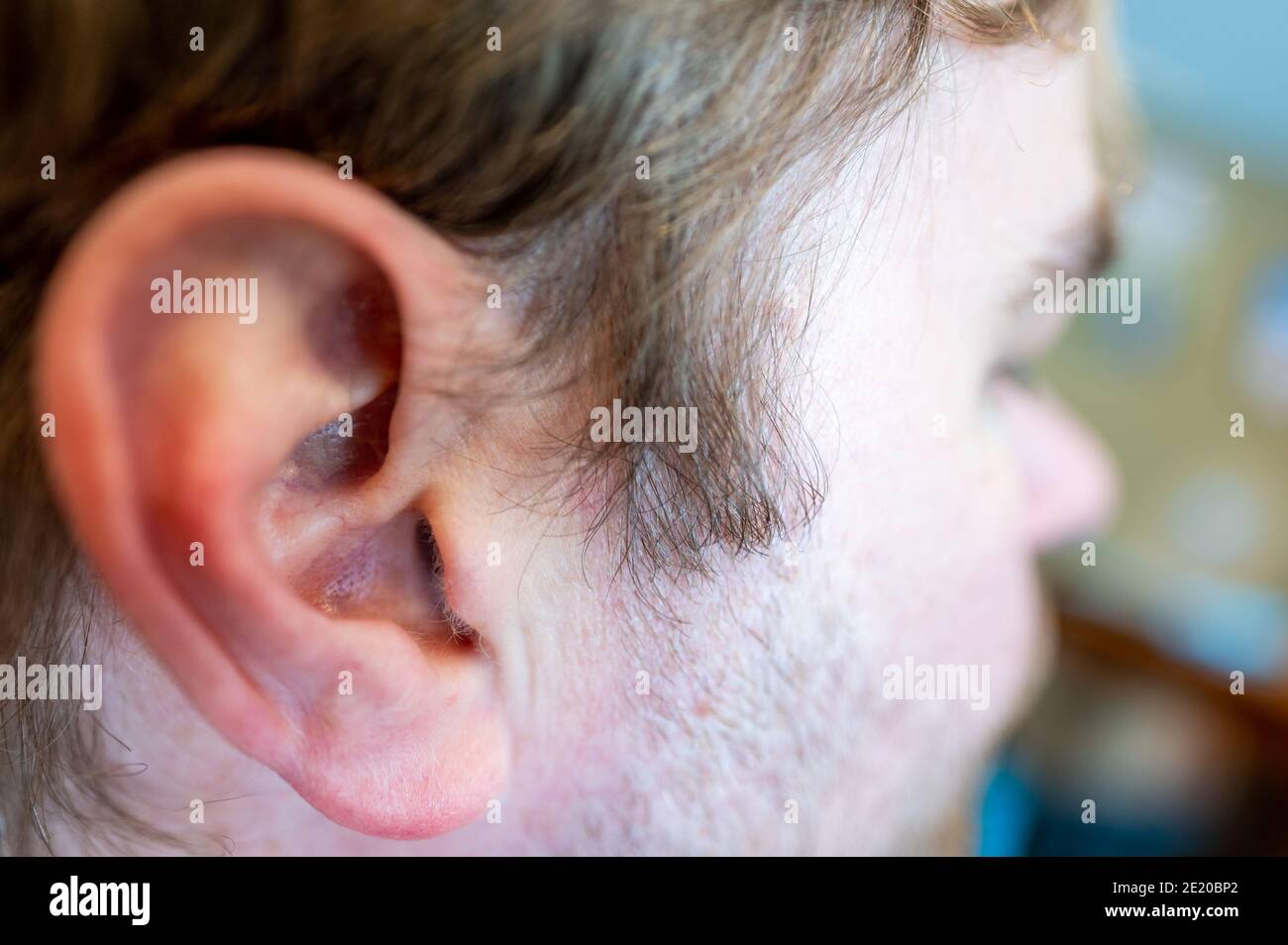 Increase in body hair in an ear caused by aging Stock Photo - Alamy