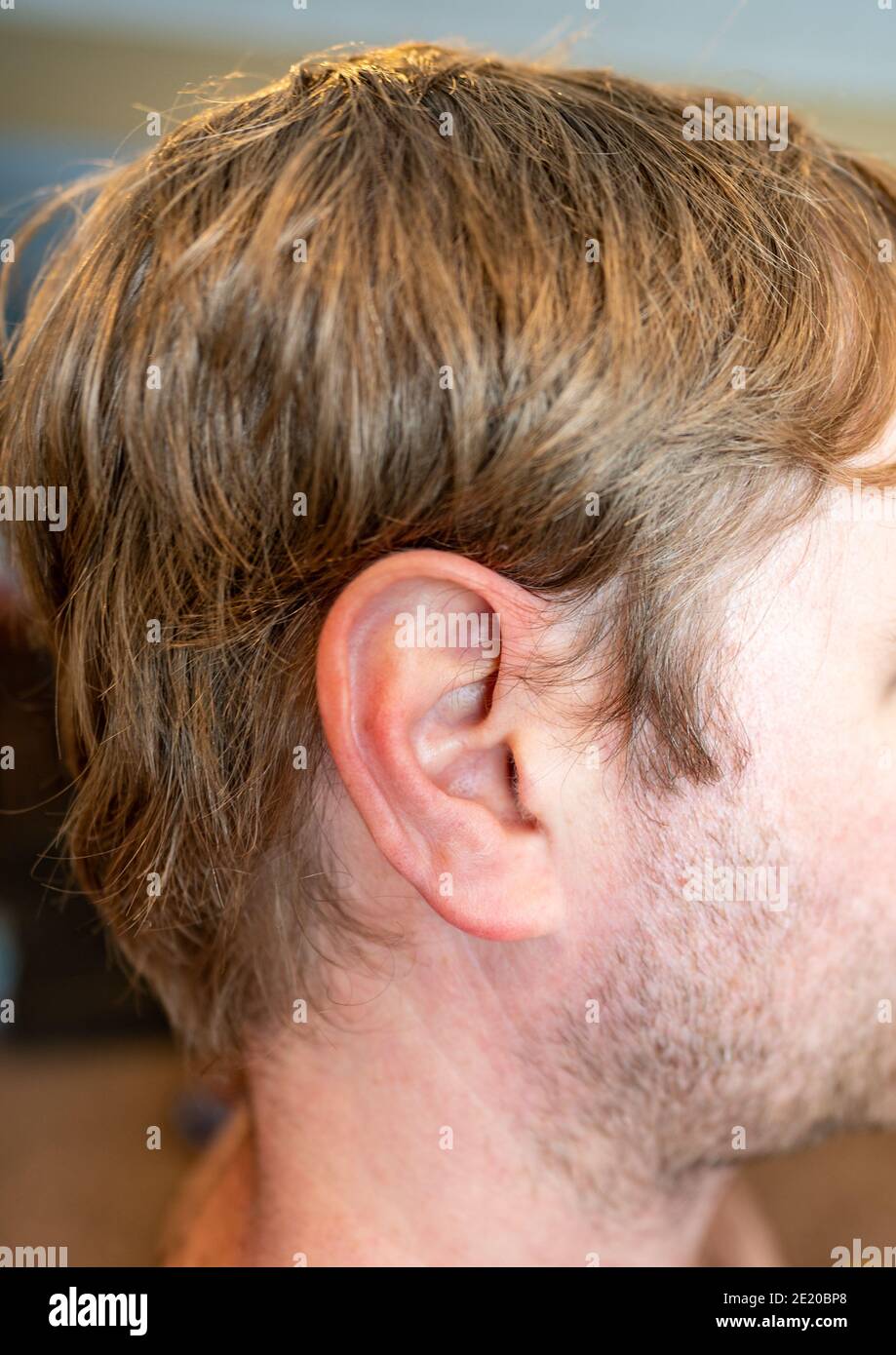 Increase in body hair in an ear caused by aging Stock Photo - Alamy