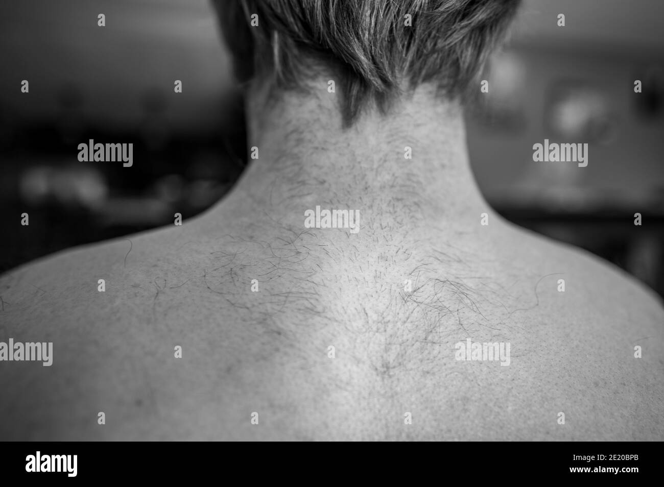 Back hair caused by increased age on a white male Stock Photo - Alamy