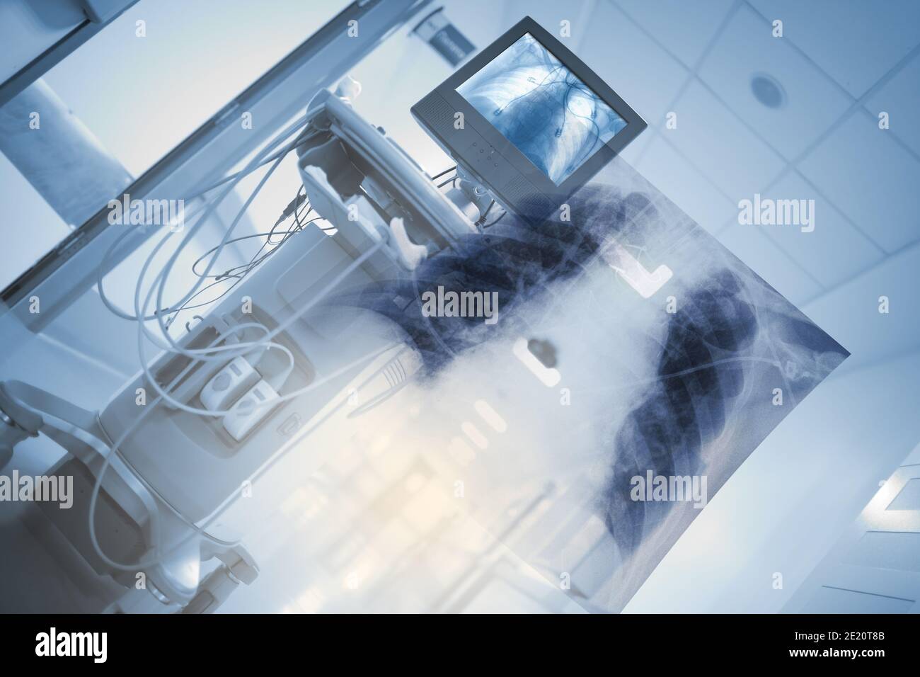 Chest x ray check hi-res stock photography and images - Alamy