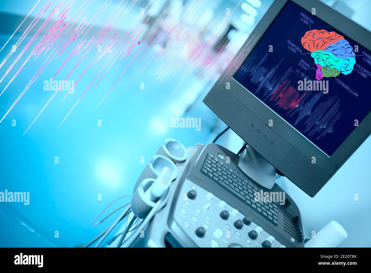 Brain examination with the modern equipment Stock Photo - Alamy