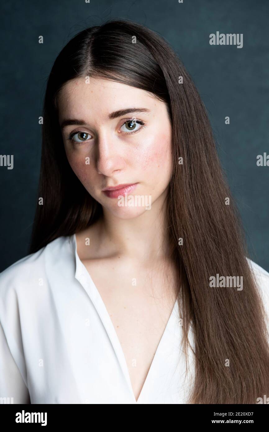 Female with skin rash on face Stock Photo - Alamy