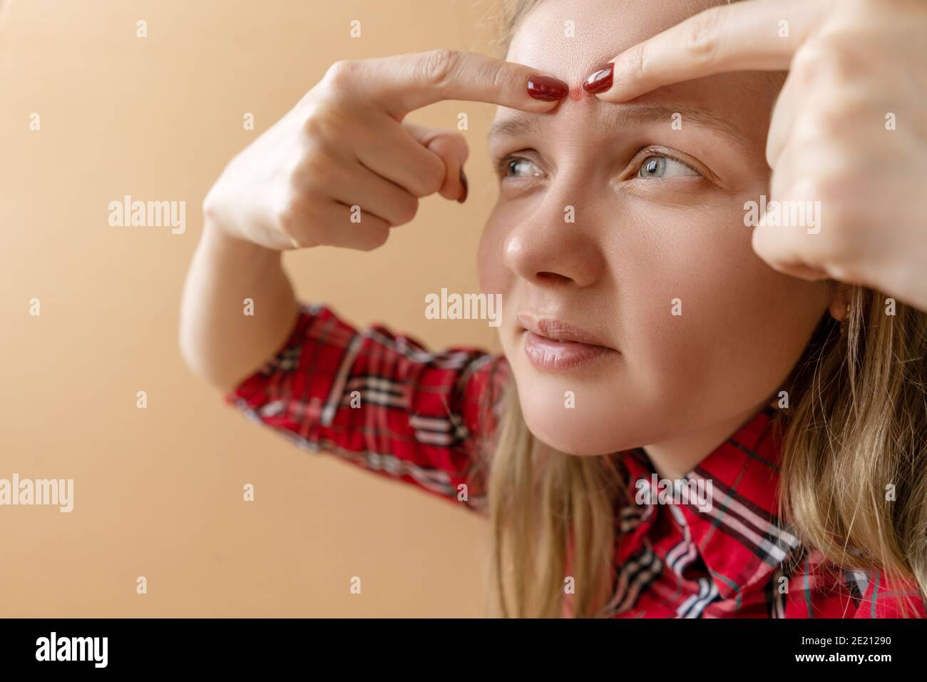 woman presses pimple on her forehead with her finger, close-up. Problem ...