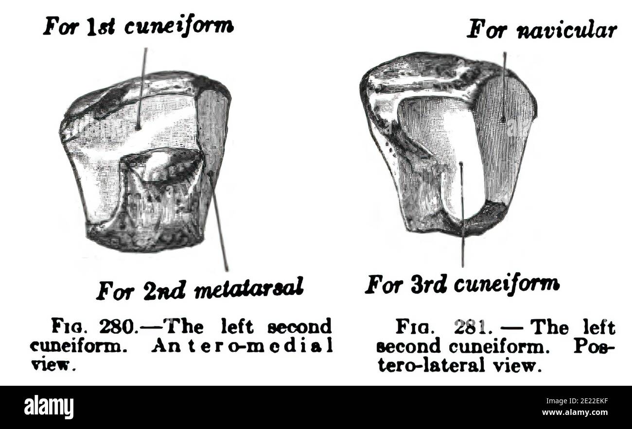 Anatomy drawing and text of the left second cuneiform, from the 19th ...