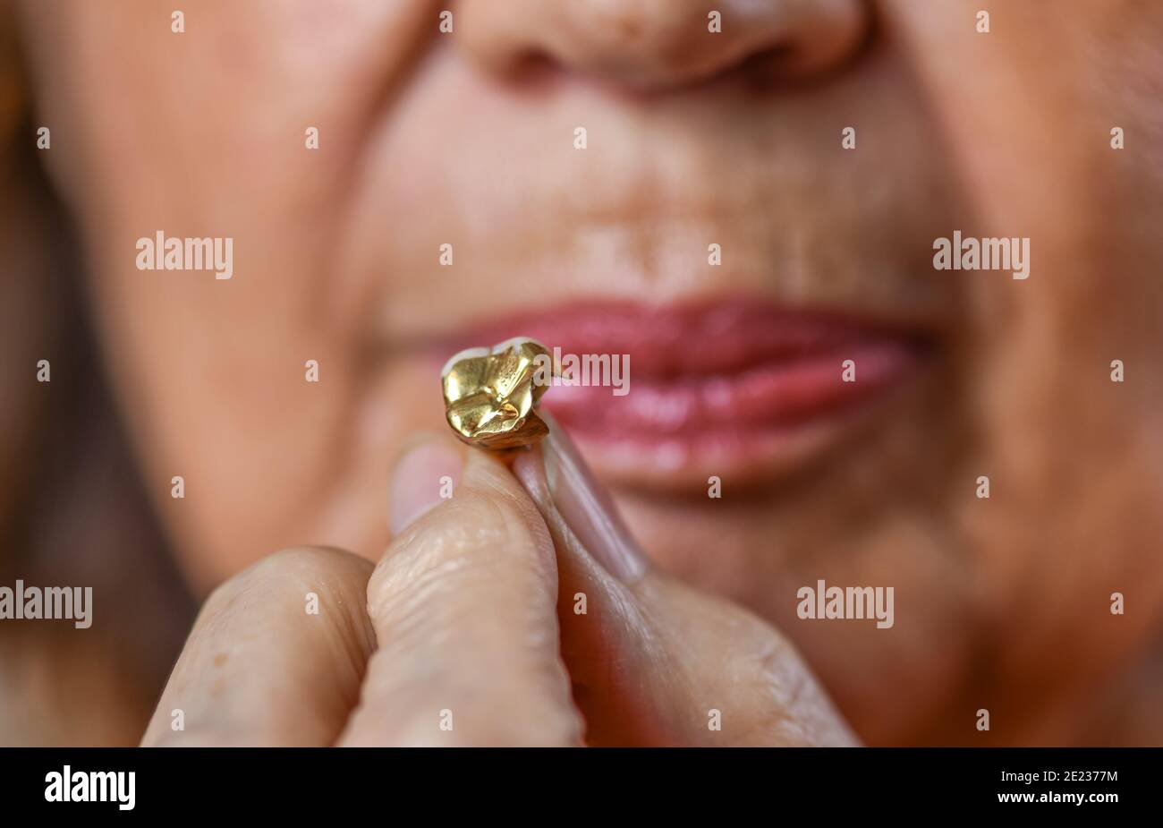 Goldene zahn hi-res stock photography and images - Alamy