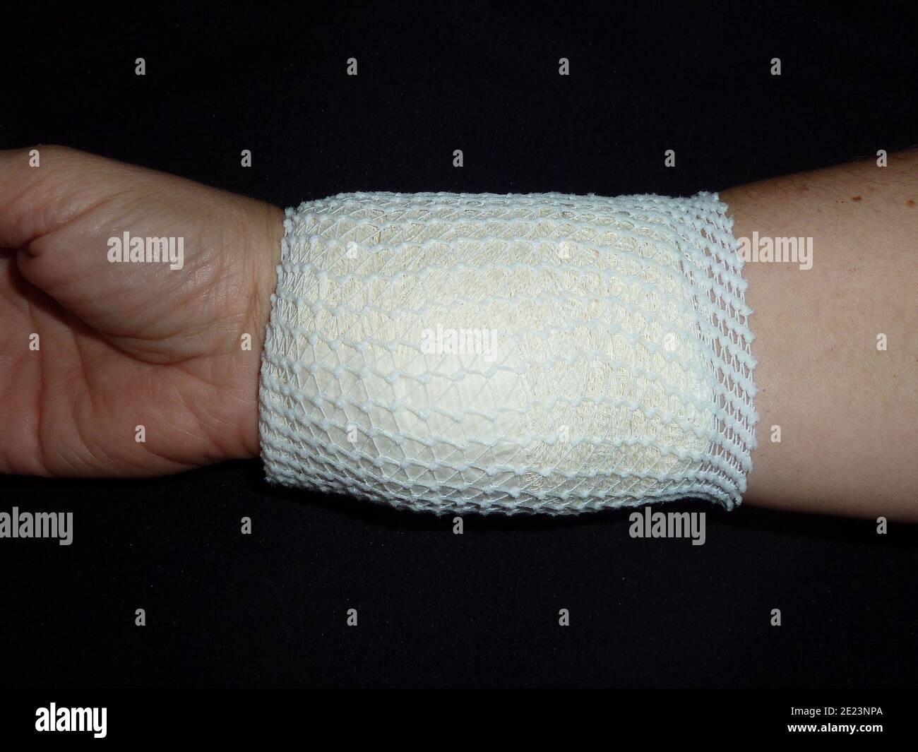 Closeup shot of a person's hand with a bandage after surgery Stock ...