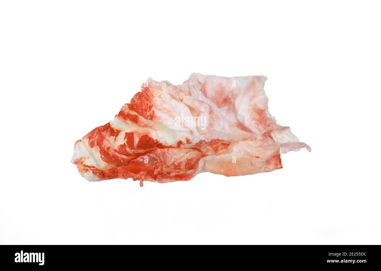 Blood in tissue paper on a white background. Epistaxis (nosebleeds ...