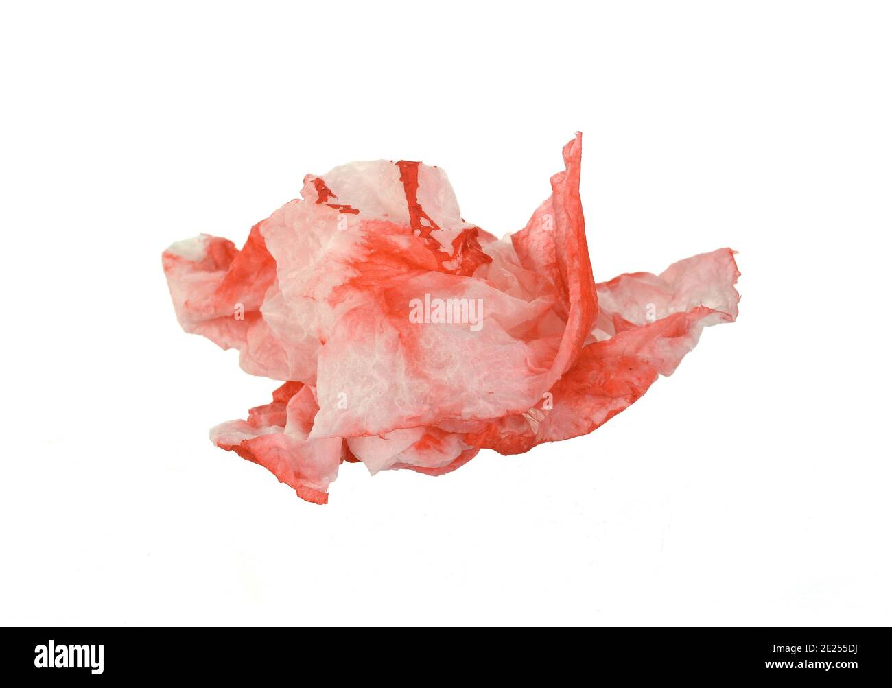 Blood in tissue paper on a white background. Epistaxis (nosebleeds ...