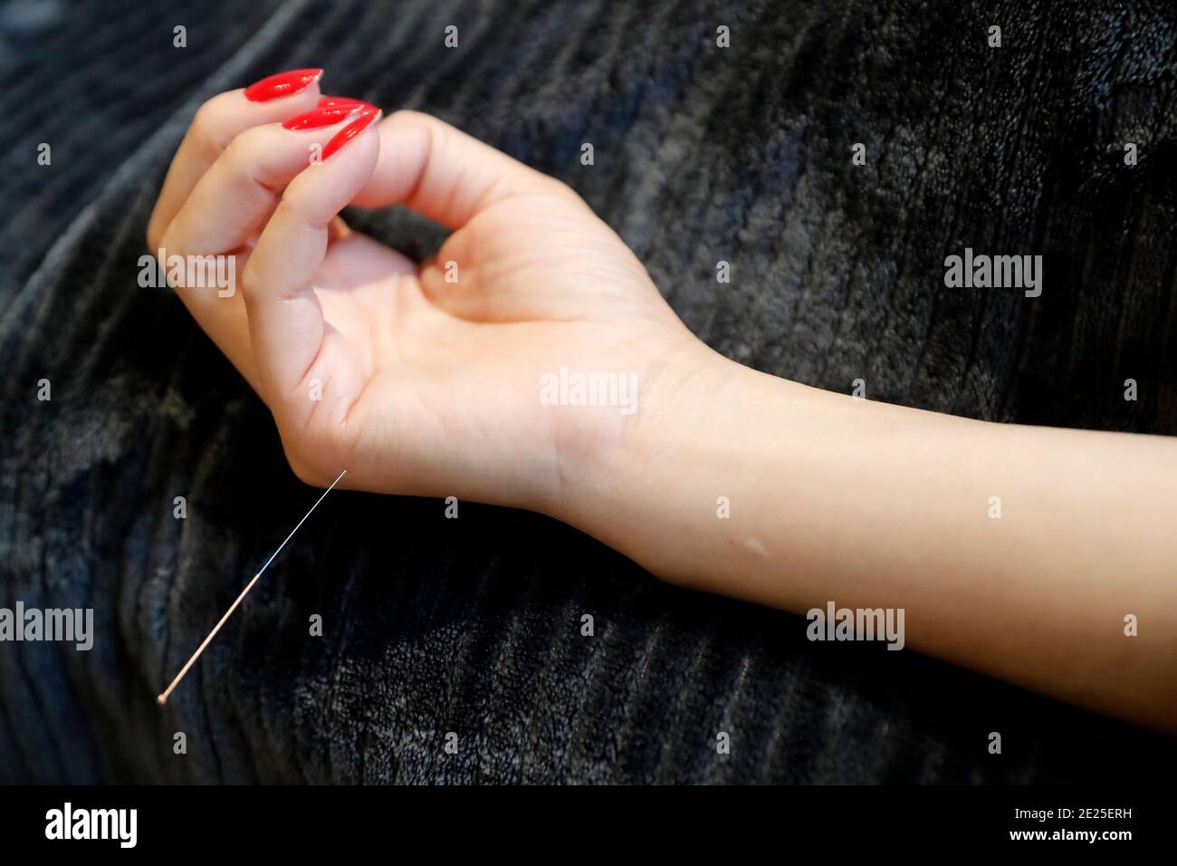 Accupuncture chinoise hi-res stock photography and images - Alamy