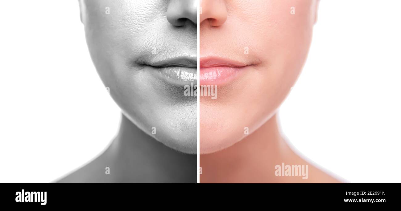 A woman's face is split in half for good and bad skin. Isolated on ...