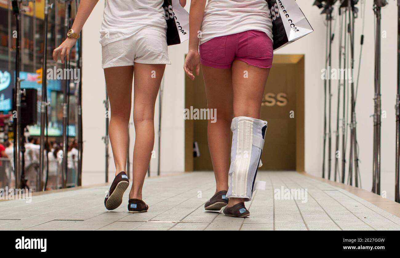 New leg cast hi-res stock photography and images - Alamy