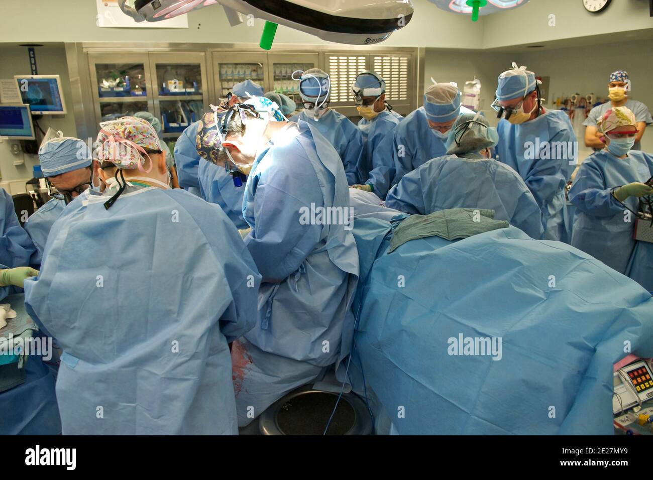 Charla Nash Hand Transplant