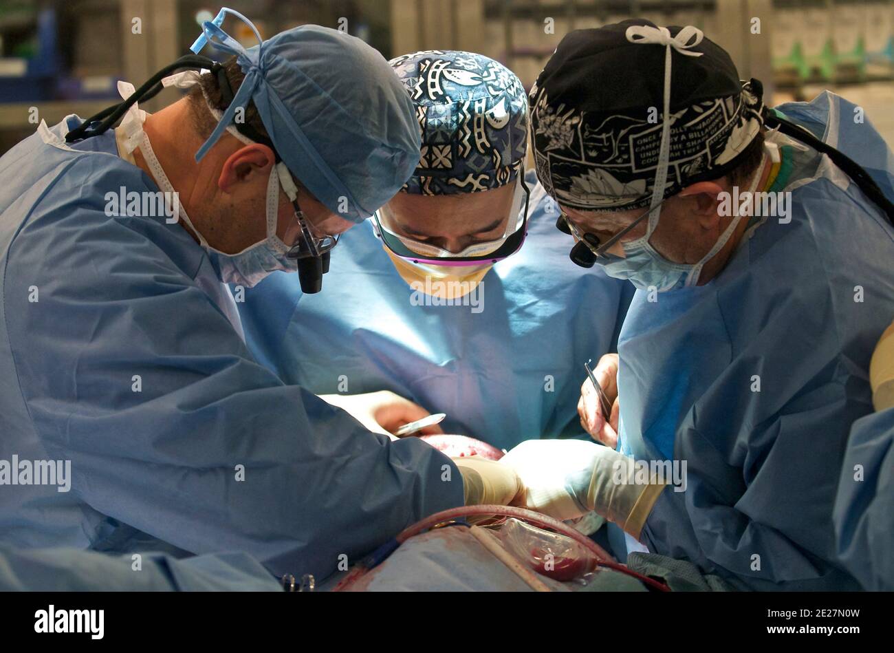 Charla Nash, 57, who was mauled by a chimpanzee in Connecticut in 2009 ...