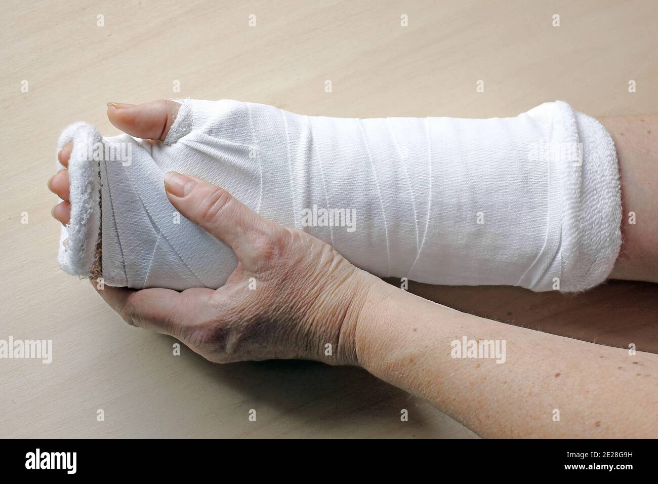 Hand splint hi-res stock photography and images - Alamy