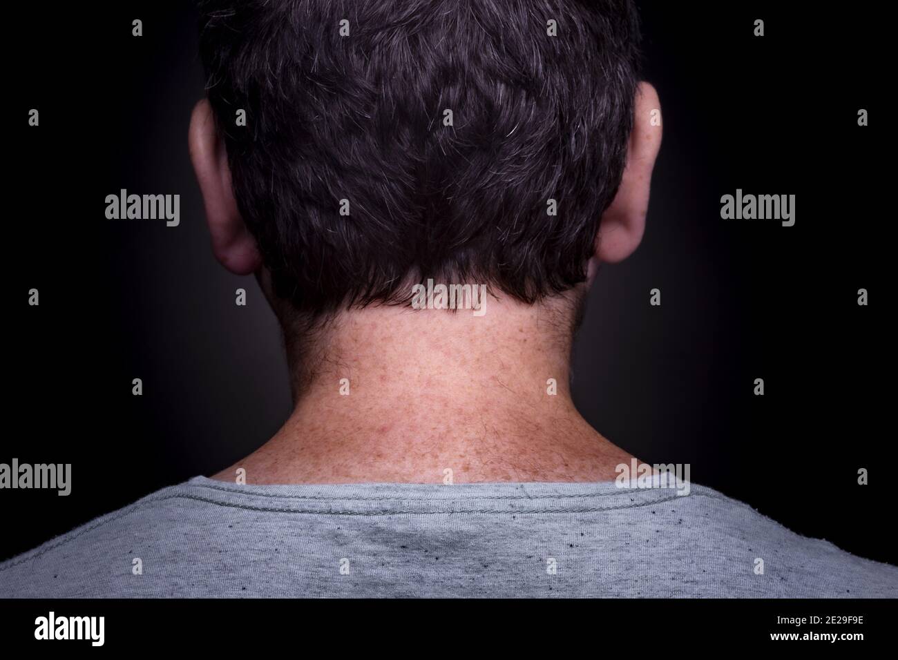 Low key neck of a male with freckles Stock Photo - Alamy