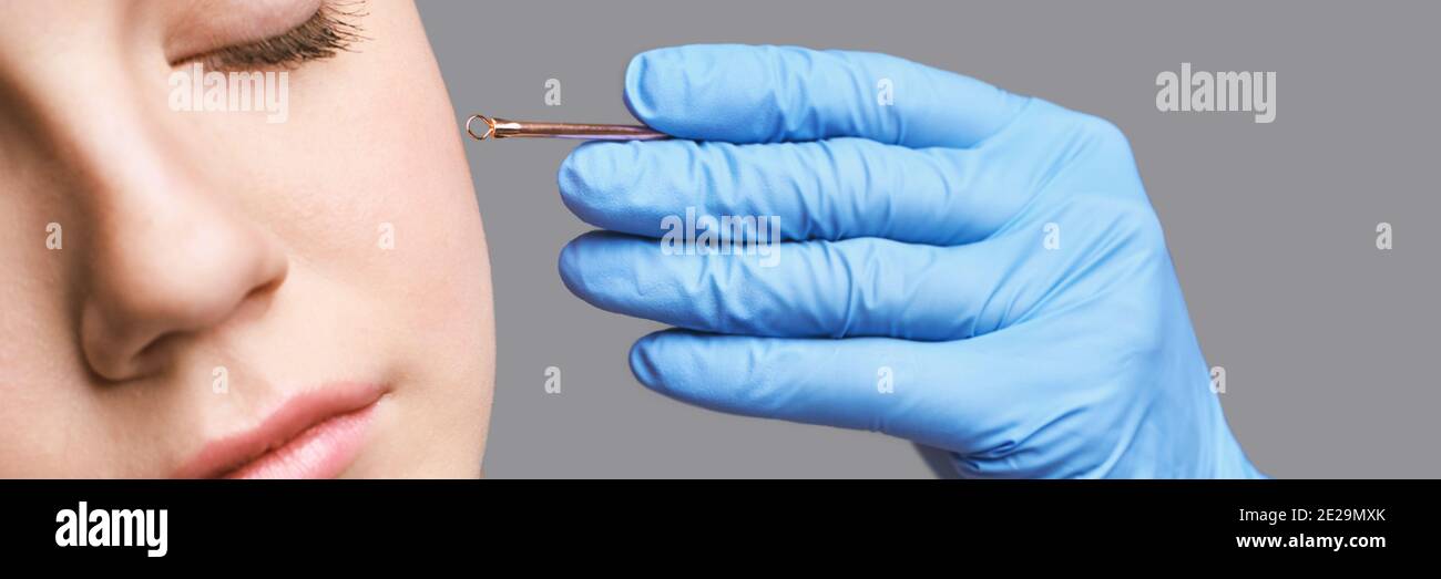 Loop device for medical design. Woman skin procedure. Natural cosmetic ...