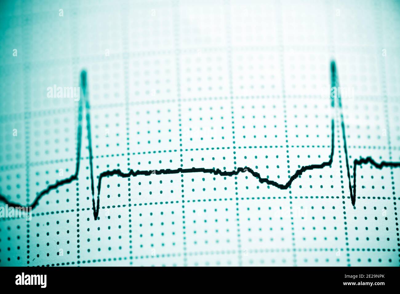 Ekg paper hi-res stock photography and images - Alamy