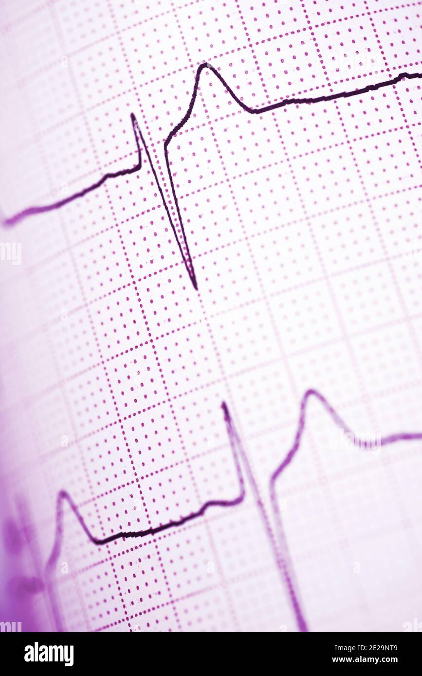 Close up of an electrocardiogram in paper form Stock Photo - Alamy