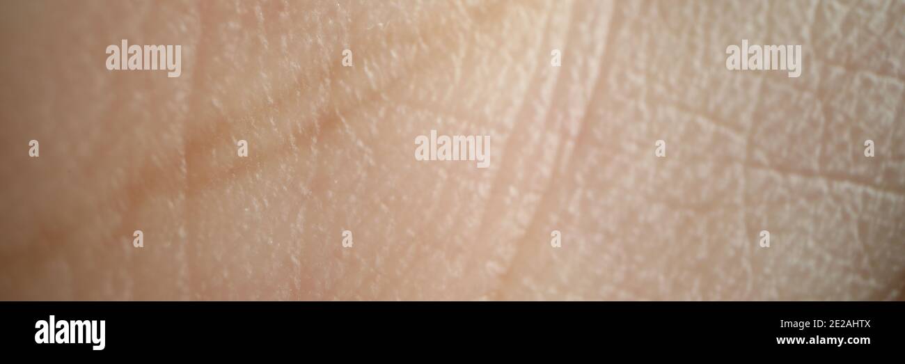 Skin surface of human palm with lines Stock Photo - Alamy